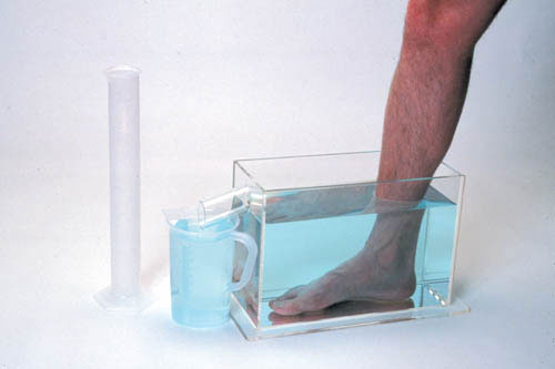 Partial Leg Volumetric Edema Set - Mid-Atlantic Medical Supply